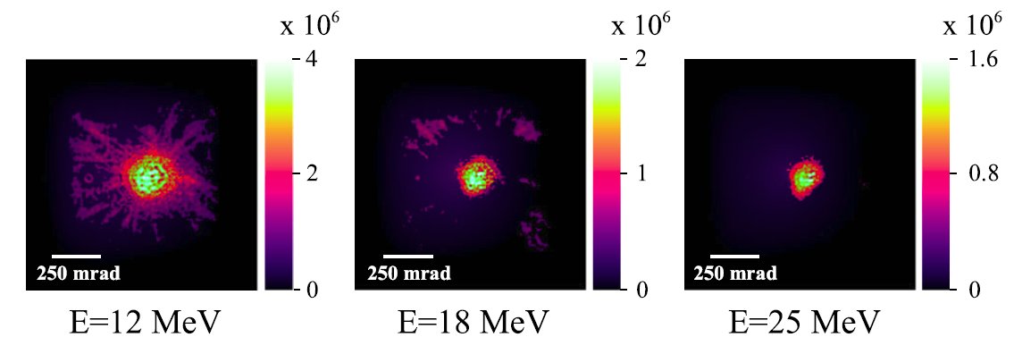 SLIC Lasers help to slim down radiotherapy equipment - IRAMIS