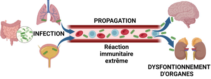 IHU Prometheus - IRAMIS